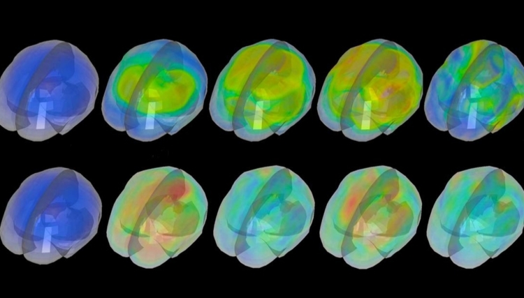 Brain Injury Modeling Reveals Deep Trauma Patterns | Stem Learning Center